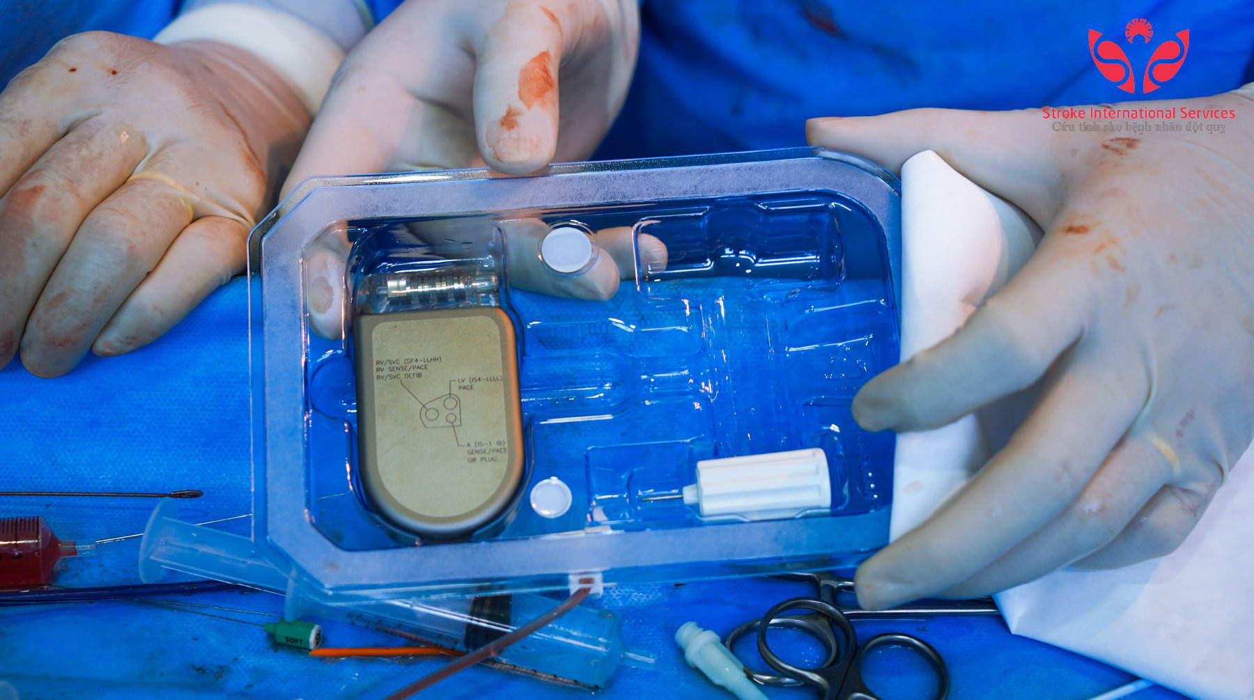 Bị gắn máy trợ tim sau tửu lượng 15 lon bia mỗi ngày - Báo Người lao động