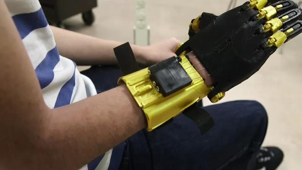 Cả lớp cùng chế tay robot cho bạn học khuyết tật