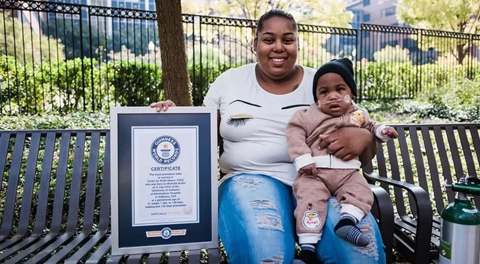 Những ca sinh nở lạ lùng nhất thế giới