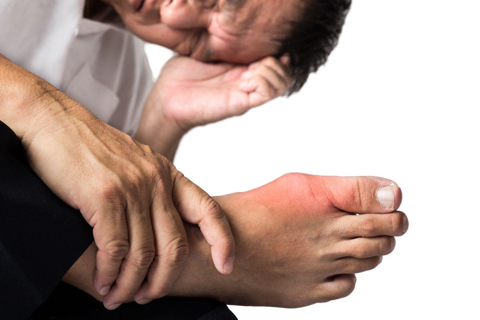 Chuyên gia Harvard: Người bệnh gout nên ăn gì?