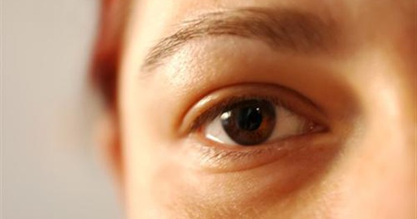 Vì sao mắt mau có cườm?